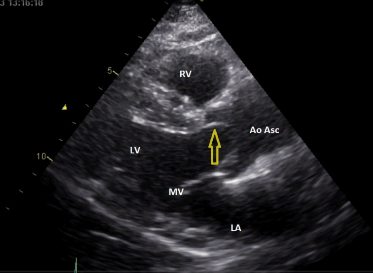 Cordiaal Multimedia 5-2013 – NVHVV